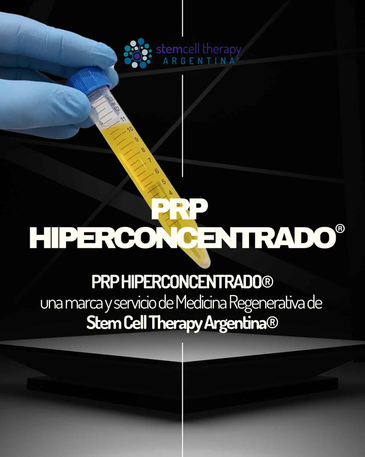PRP Hiperconcentrado® una marca de Stem Cell Therapy Argentina® , que resulta ser utilizada sin ...