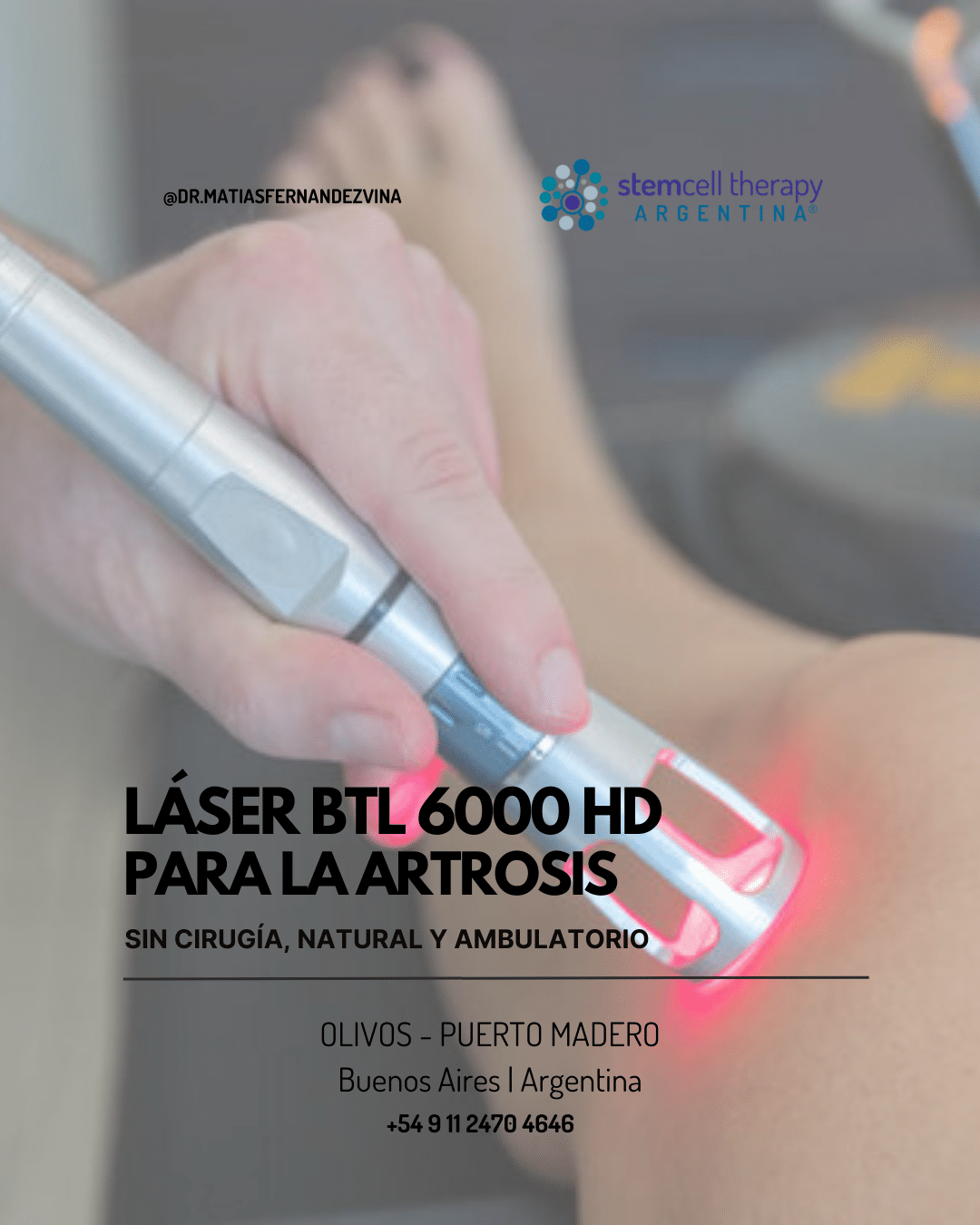 Revoluciona tu Tratamiento de la Artrosis con el Láser BTL 6000HD ...